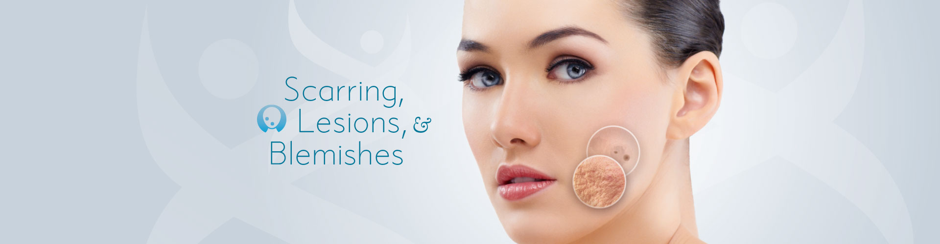 Scarring, Lesions & Blemishes Treatments | Preventous